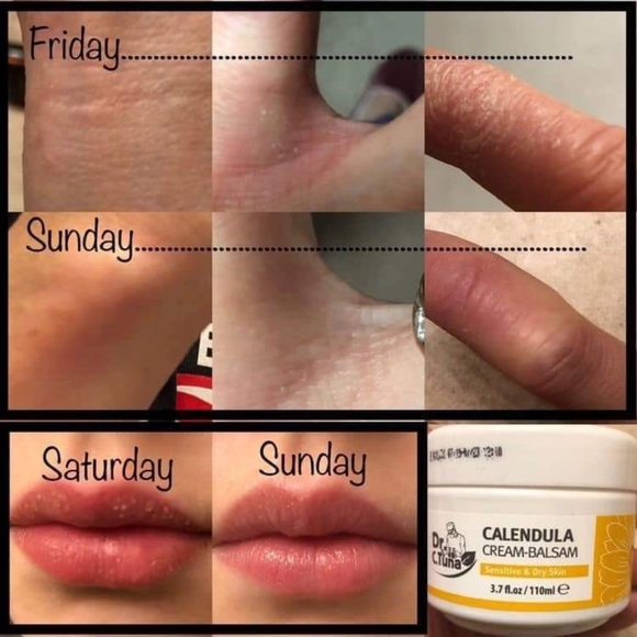 Skincare | Calendula Balsam Cream | Poshmark